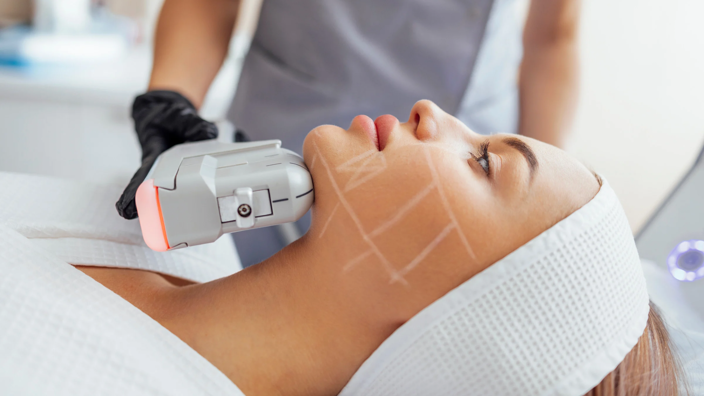 Tratamiento facial HIFU:beneficios para tu piel y para tu spa