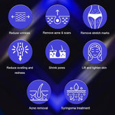 Metamorph Golden Youth Microneedling Machine | Skin Treatment Machine ...